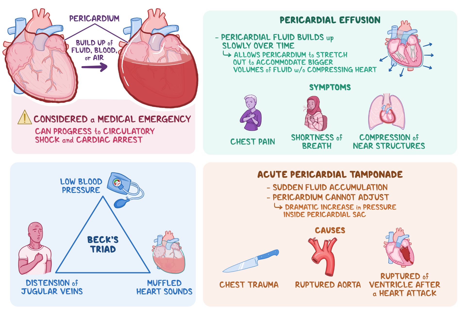 Osmosis Pericardial Tamponade What Is It Causes Pericardial
